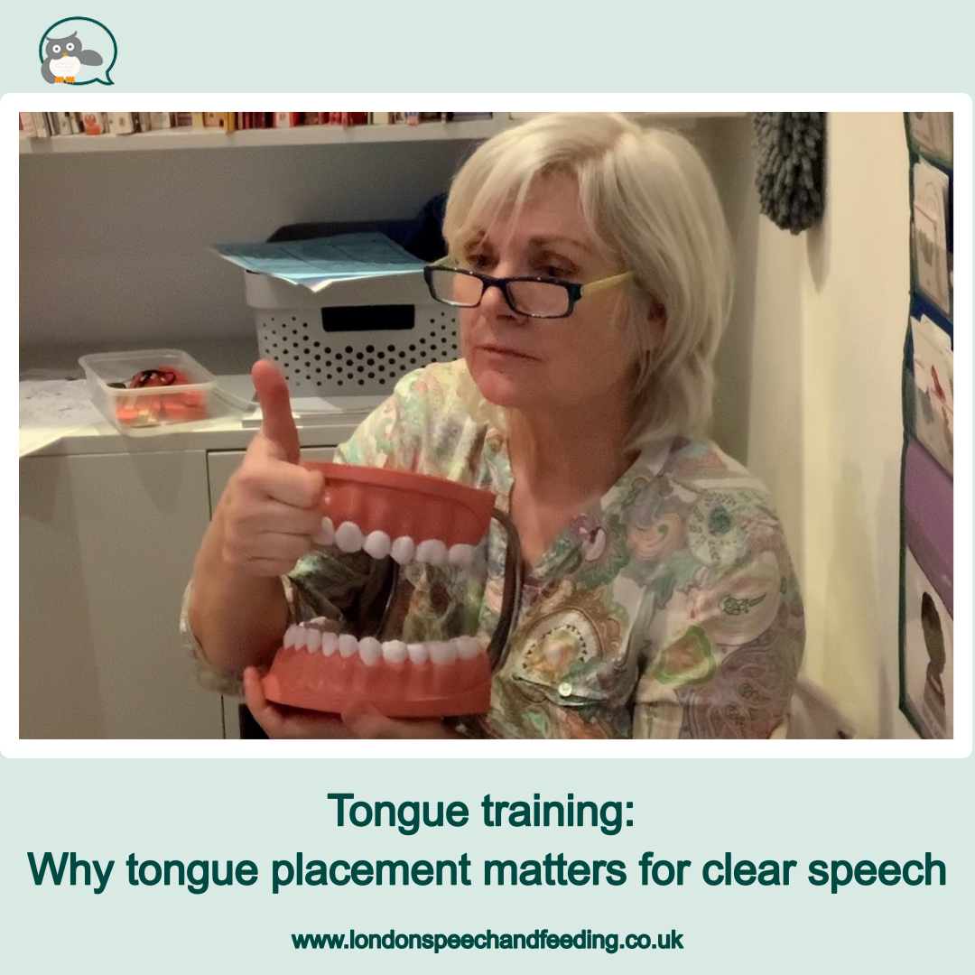 Help! My child has a lisp. What can we do about it? – The London Speech ...